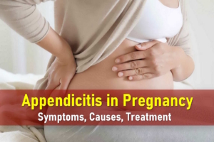 Appendicitis in Pregnancy: Symptoms, Treatment