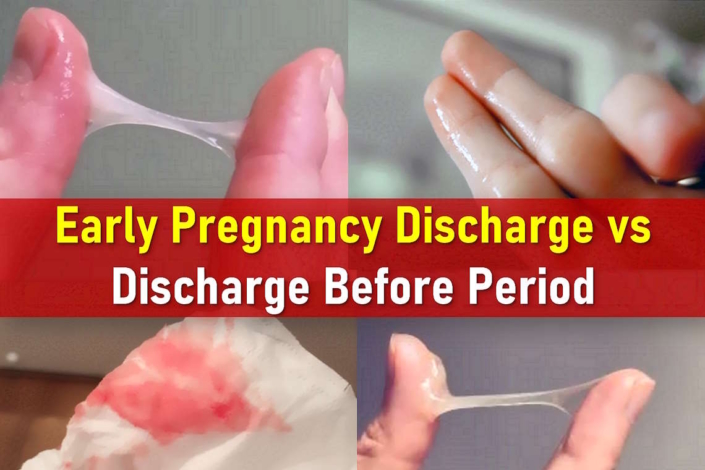 Early Pregnancy Discharge vs Discharge Before Period