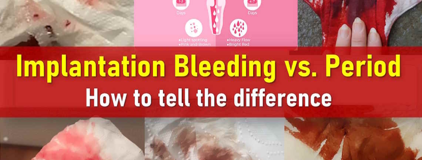 Implantation Bleeding vs. Period: Signs, Symptoms, and Key Differences