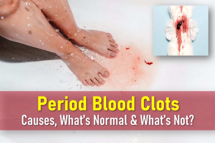 What Are Period Blood Clots: Causes, What’s Normal and What’s Not?