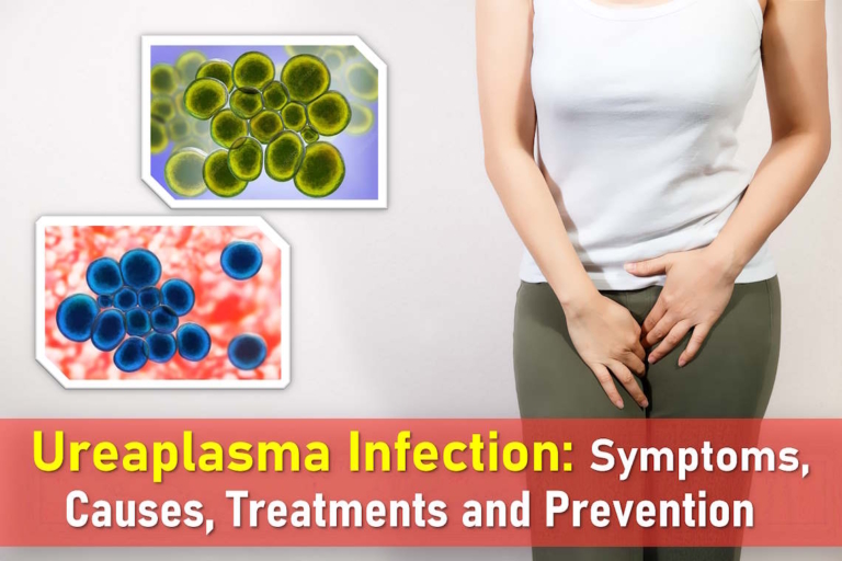 Ureaplasma Infection: Symptoms, Causes, Treatments and Prevention